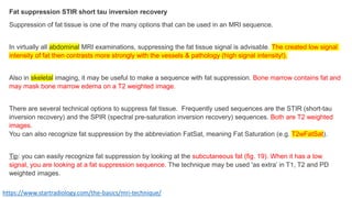 STIR Short TI OR tau Inversion Recovery.pptx