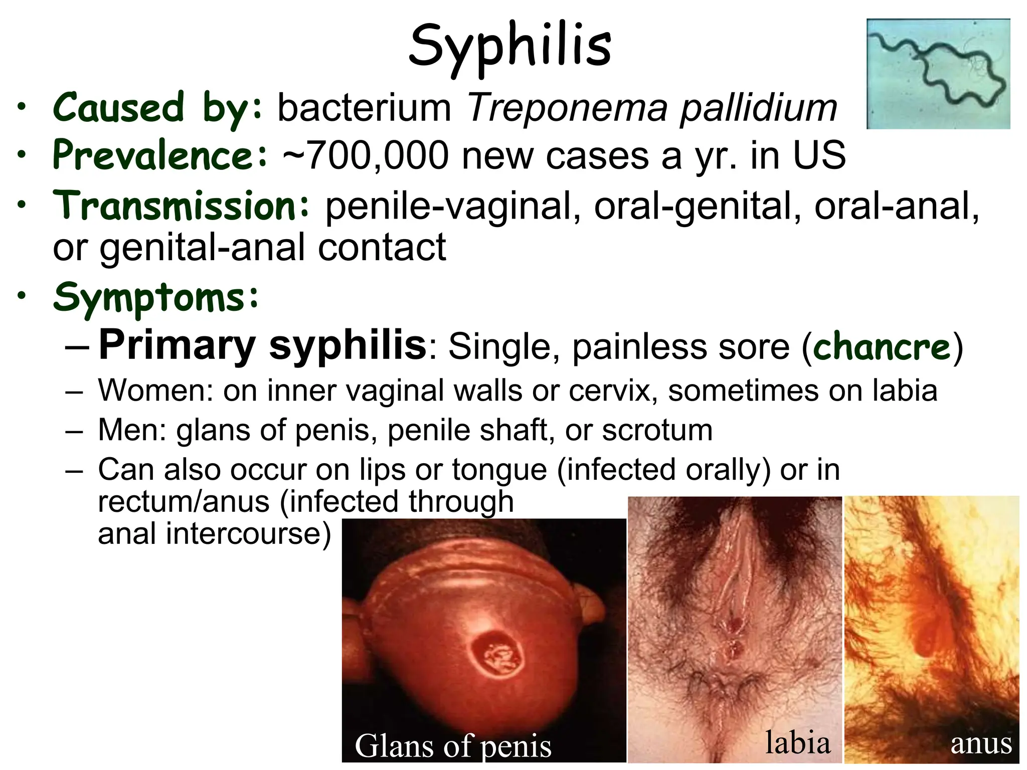 Sexually transmitted disease Nursing management of patients with ...