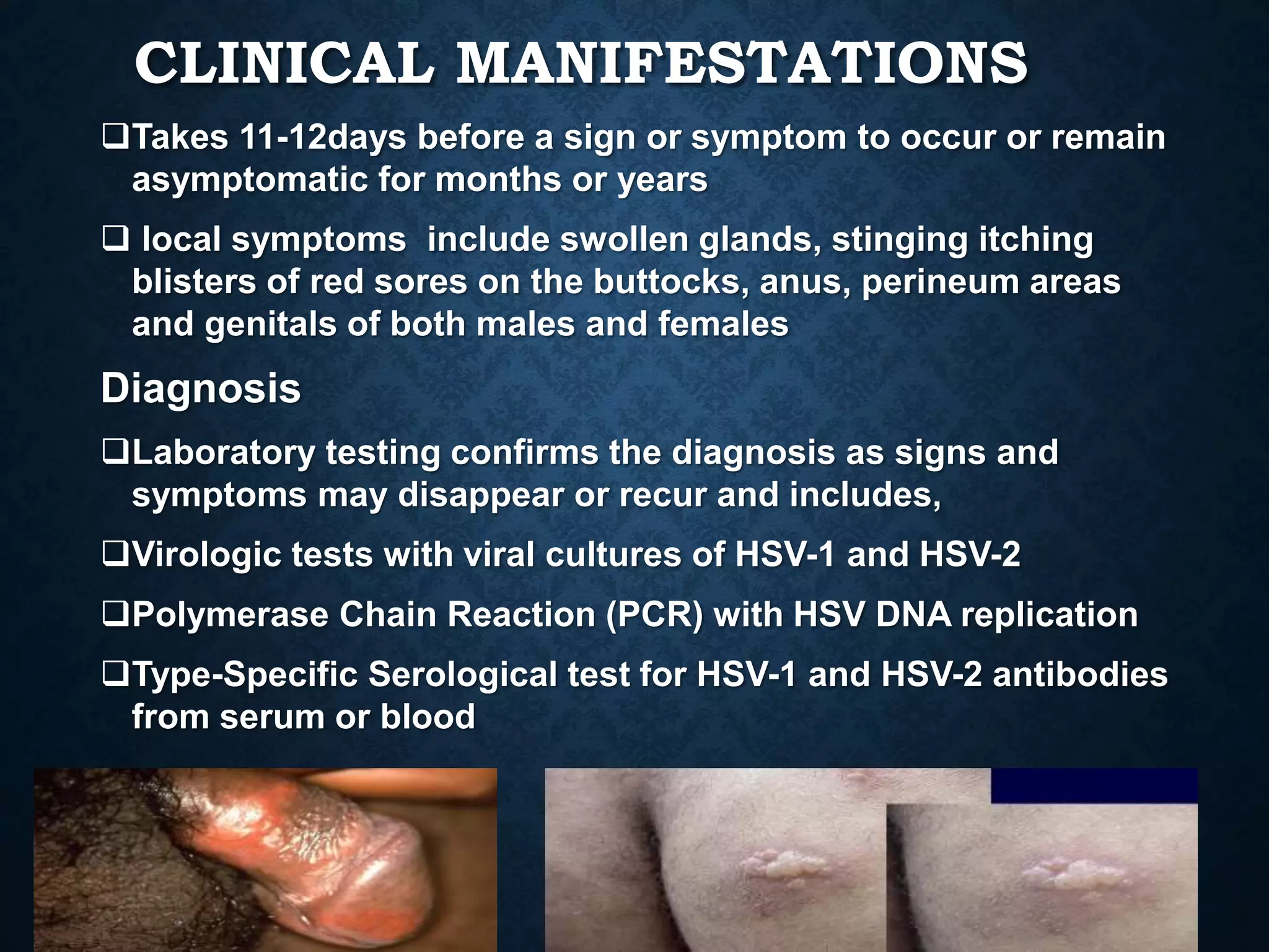 STIs-Genital Ulcer Syndrome presentation. | PPTX