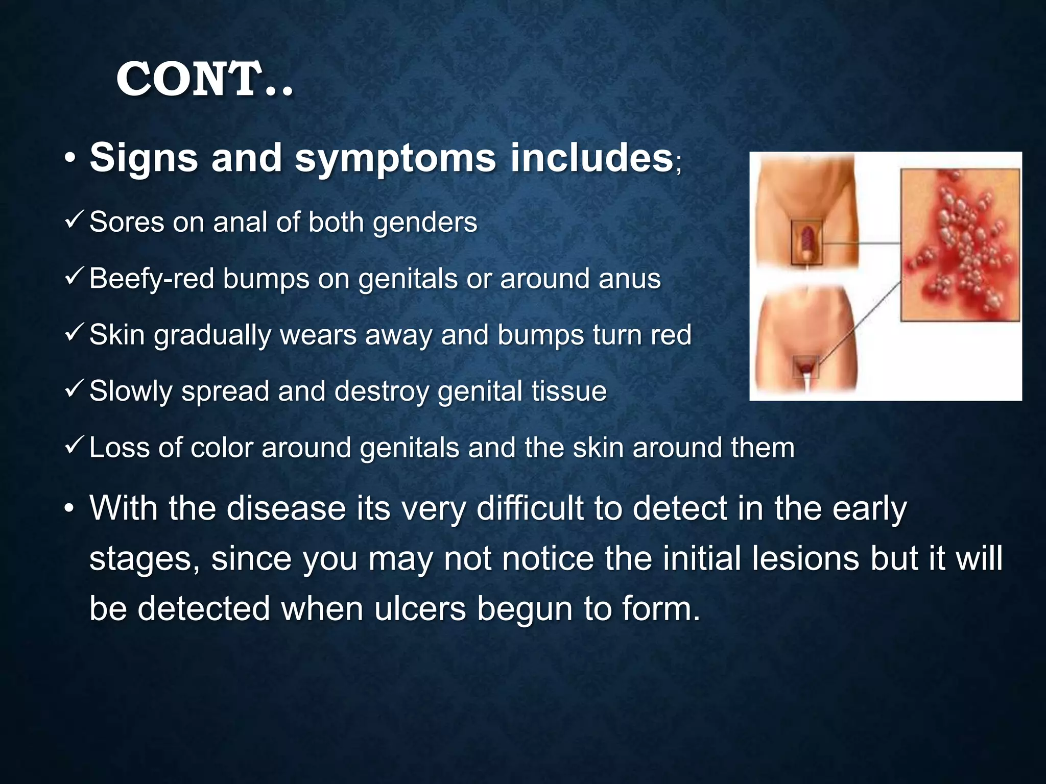 STIs-Genital Ulcer Syndrome presentation. | PPTX