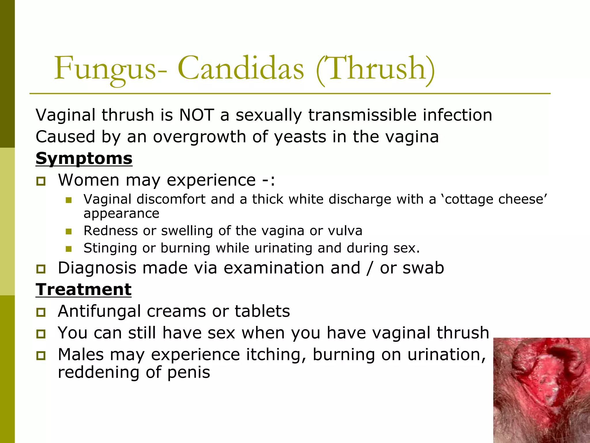 Sti's updated-What you need to know | PPTX