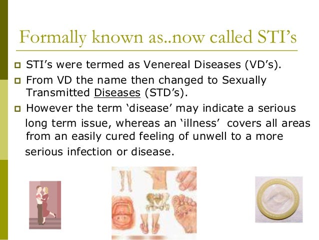 Sti's updated-What you need to know