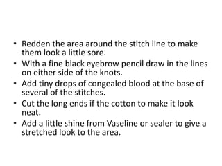 Stitched wounds | PPTX