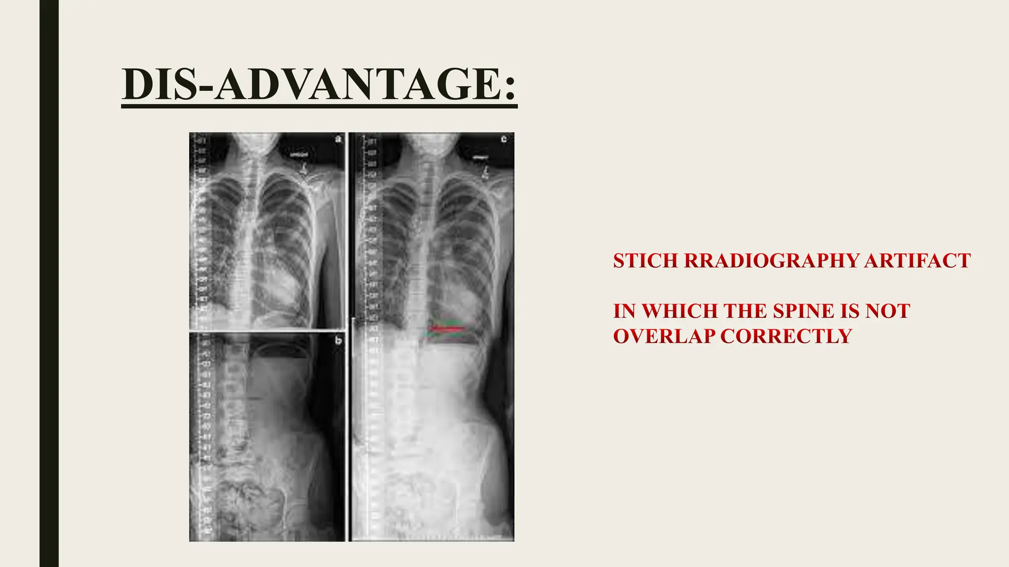 STITCH RADIOGRAPHY TECHNIQUES AND METHODS.pptx