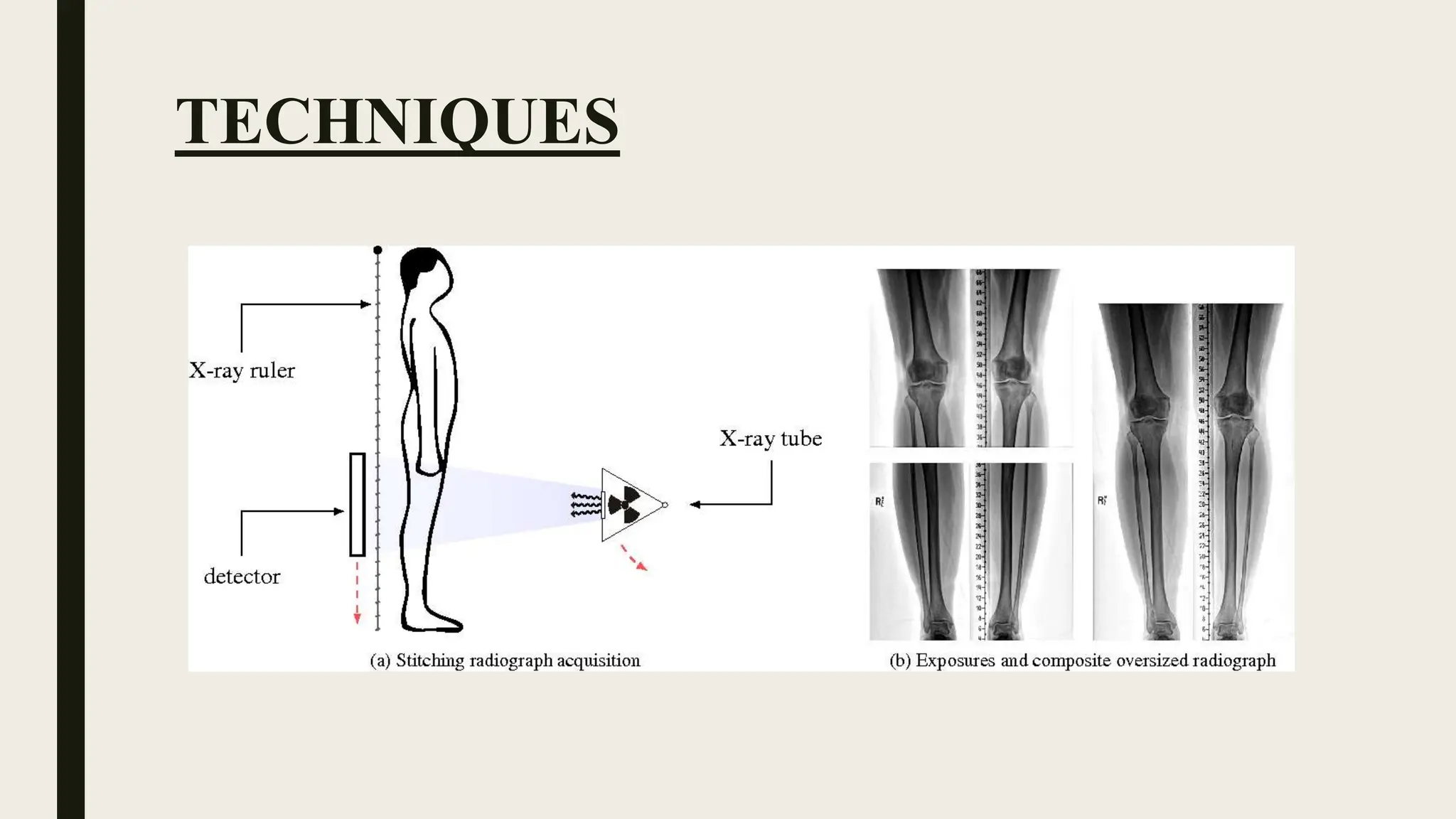 STITCH RADIOGRAPHY TECHNIQUES AND METHODS.pptx