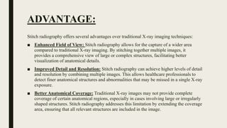 STITCH RADIOGRAPHY TECHNIQUES AND METHODS.pptx