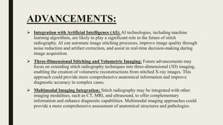 STITCH RADIOGRAPHY TECHNIQUES AND METHODS.pptx