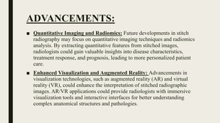 STITCH RADIOGRAPHY TECHNIQUES AND METHODS.pptx