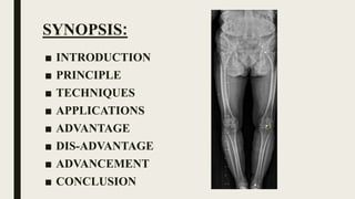 STITCH RADIOGRAPHY TECHNIQUES AND METHODS.pptx