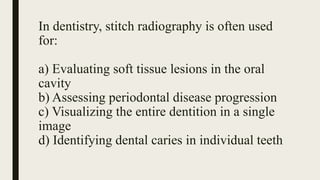 STITCH RADIOGRAPHY TECHNIQUES AND METHODS.pptx