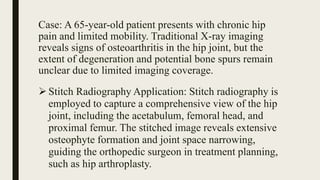 STITCH RADIOGRAPHY TECHNIQUES AND METHODS.pptx