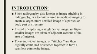 STITCH RADIOGRAPHY TECHNIQUES AND METHODS.pptx