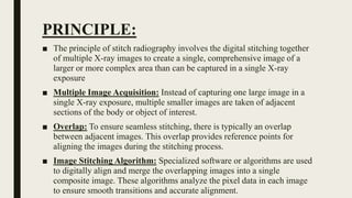 STITCH RADIOGRAPHY TECHNIQUES AND METHODS.pptx