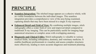 STITCH RADIOGRAPHY TECHNIQUES AND METHODS.pptx