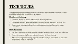 STITCH RADIOGRAPHY TECHNIQUES AND METHODS.pptx