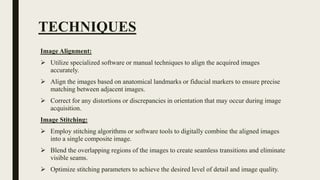 STITCH RADIOGRAPHY TECHNIQUES AND METHODS.pptx