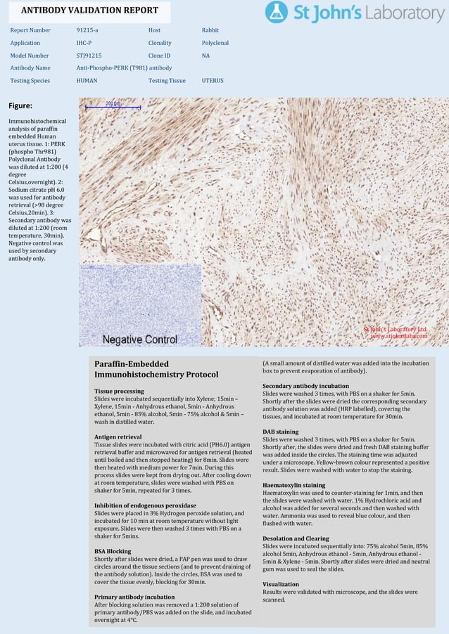 Immunohistochemistry Antibody Validation Report for Anti-Phospho-PERK ...