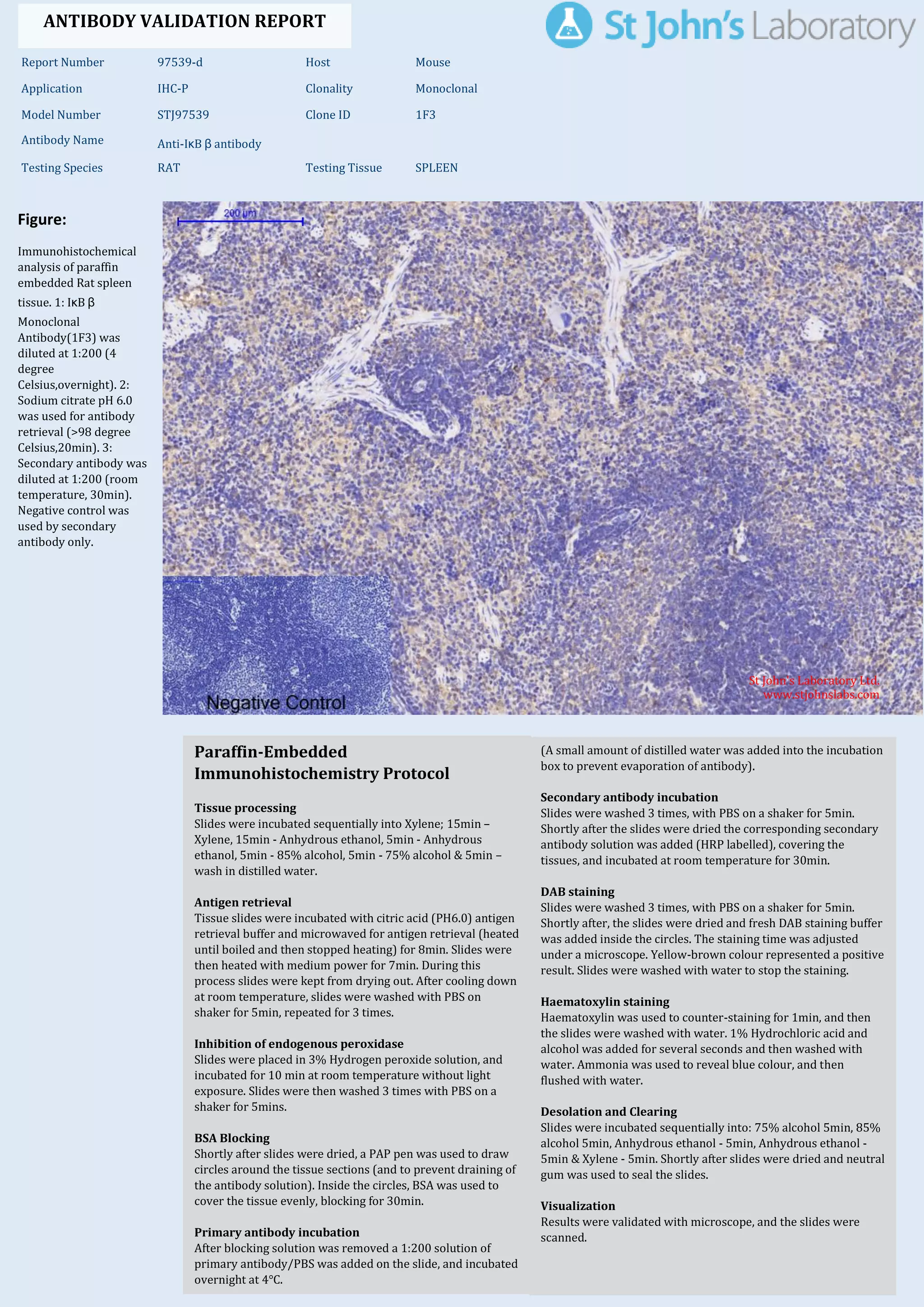 Immunohistochemistry Antibody Validation Report for Anti-IκB β Antibody ...
