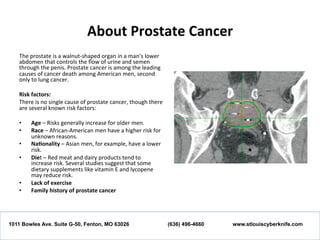 Prostate Cancer: CyberKnife® Treatment Overview | PDF