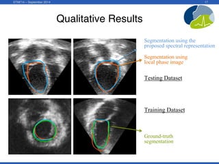 Sparsity Based Spectral Embedding: Application to Multi-Atlas Echocardiography Segmentation | PPT