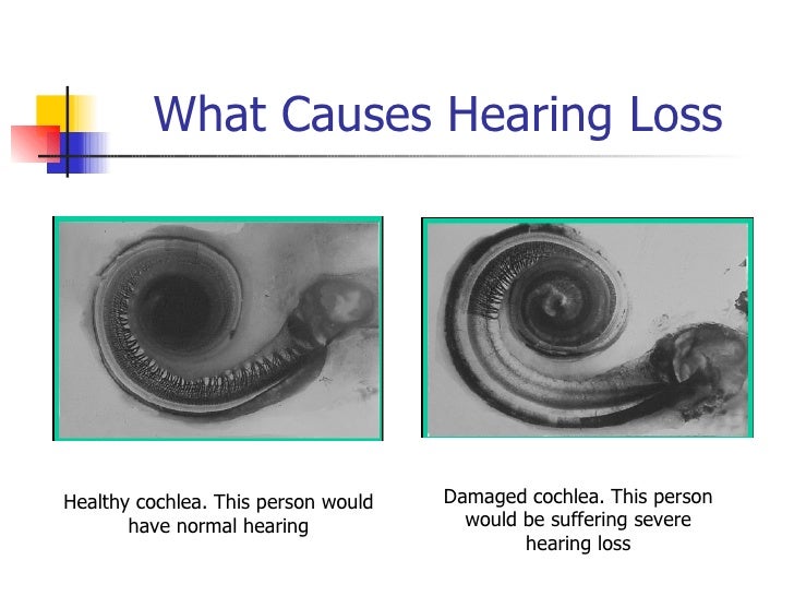 Stoddard Presentation English (Miguel) 2009
