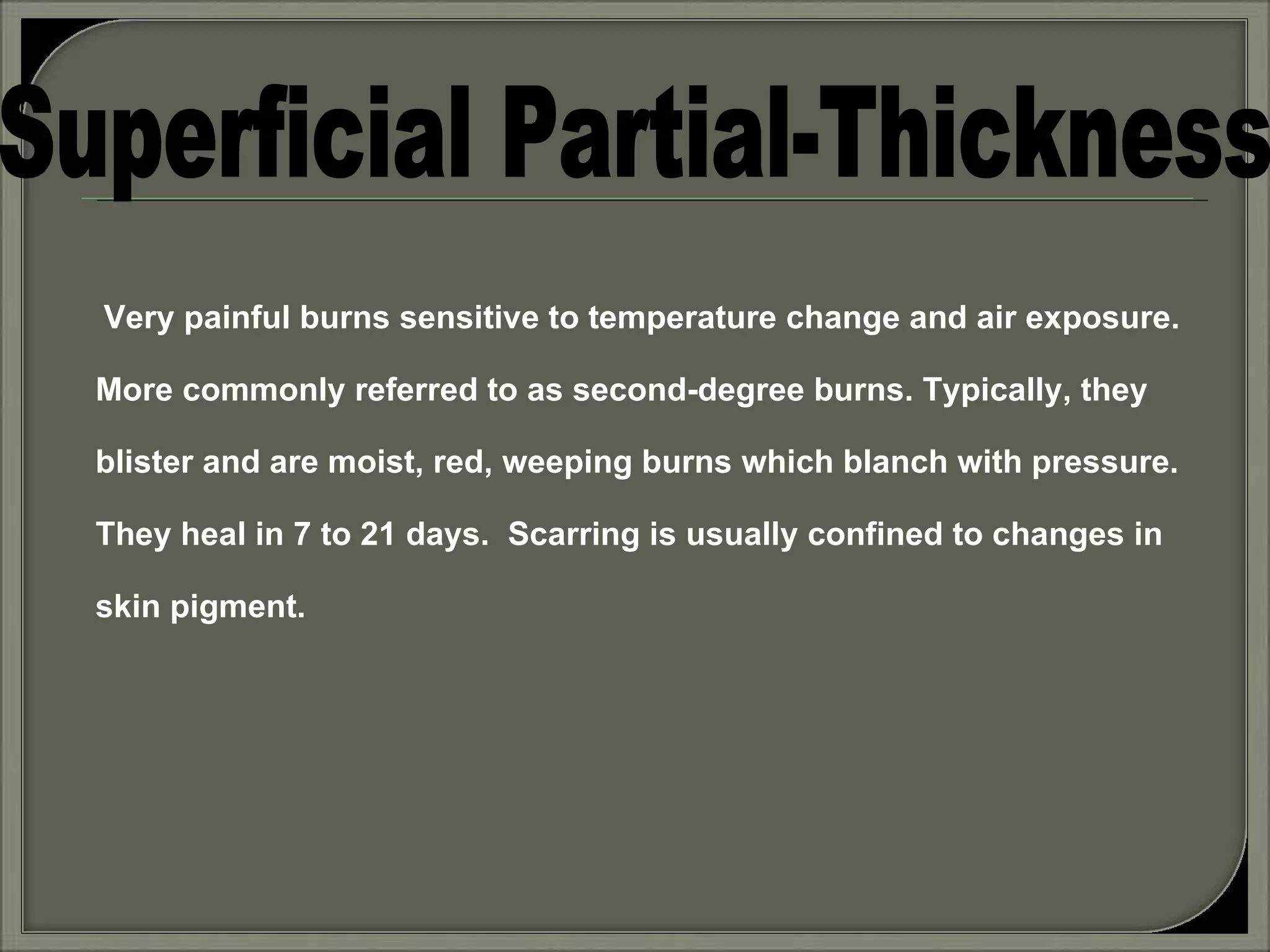 Burn Safety Training | PPT