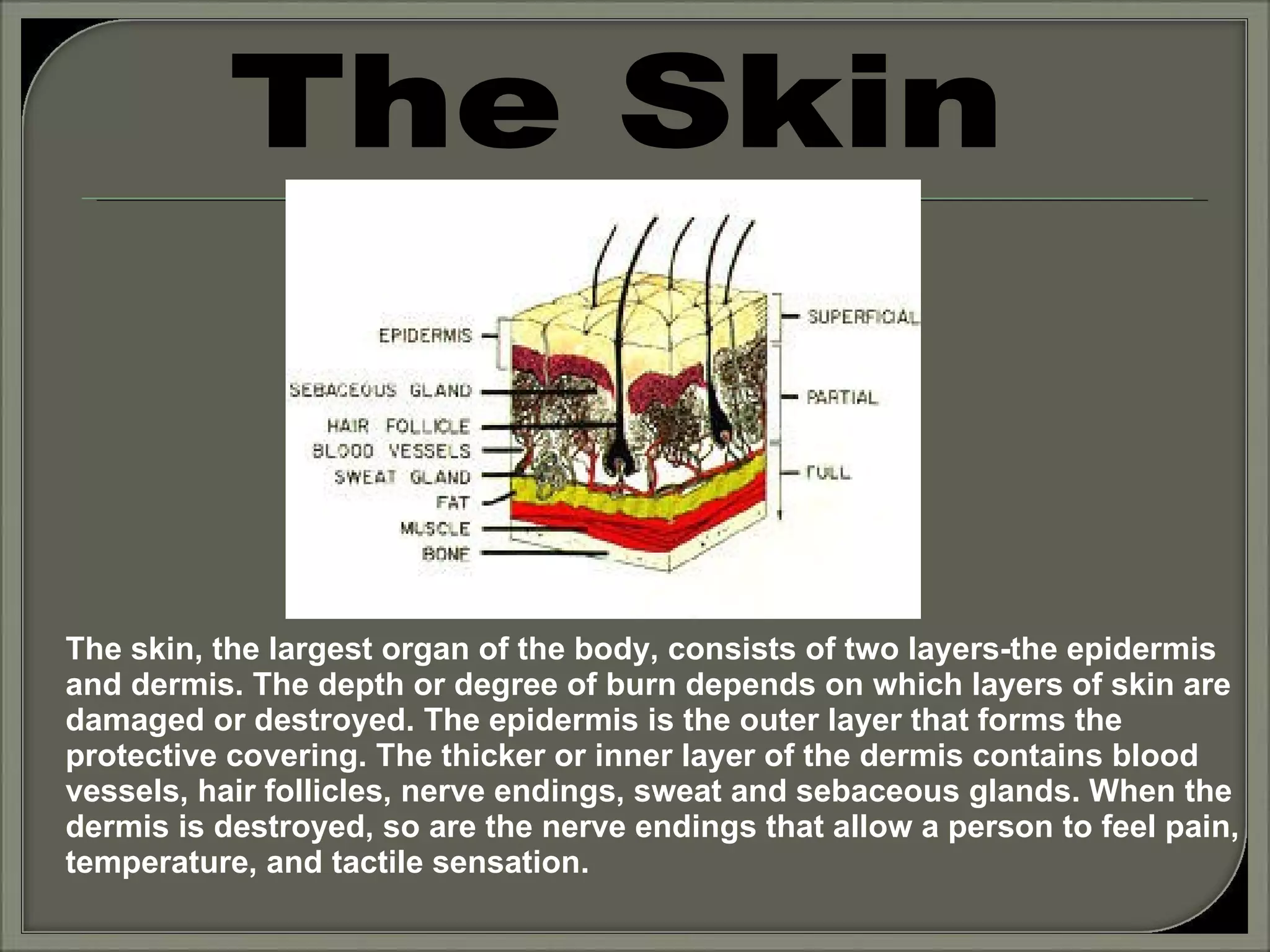 Burn Safety Training | PPT