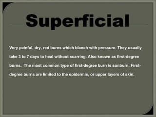 Burn Safety Training | PPT