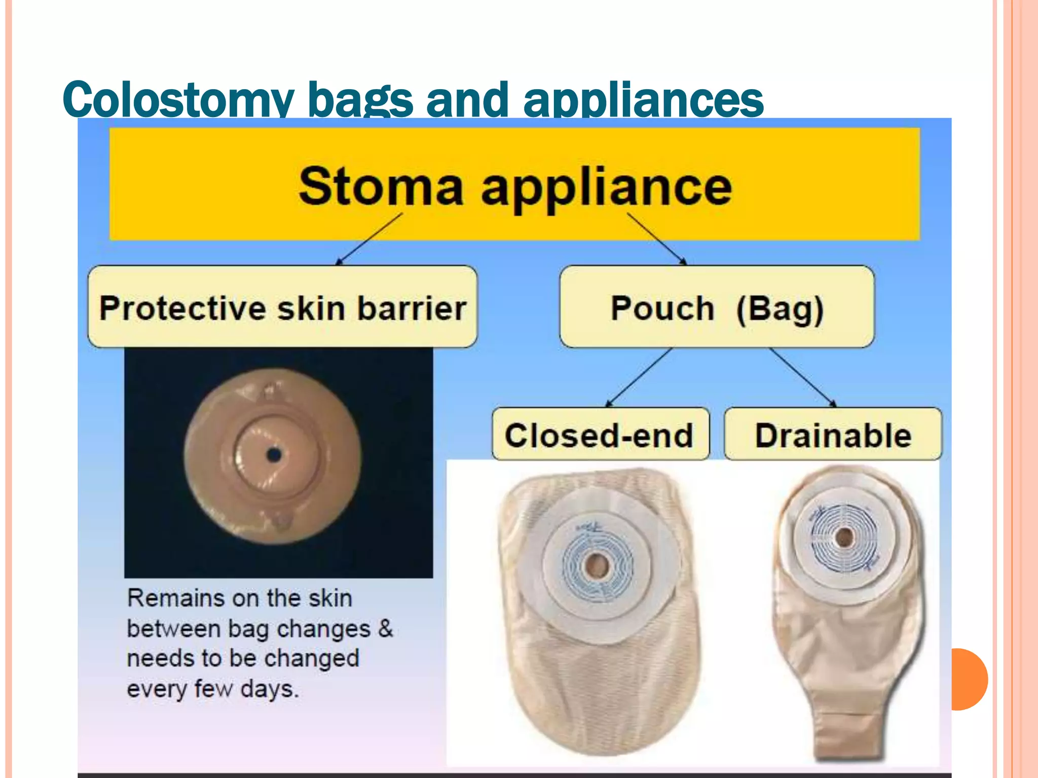 Stoma | PPTX