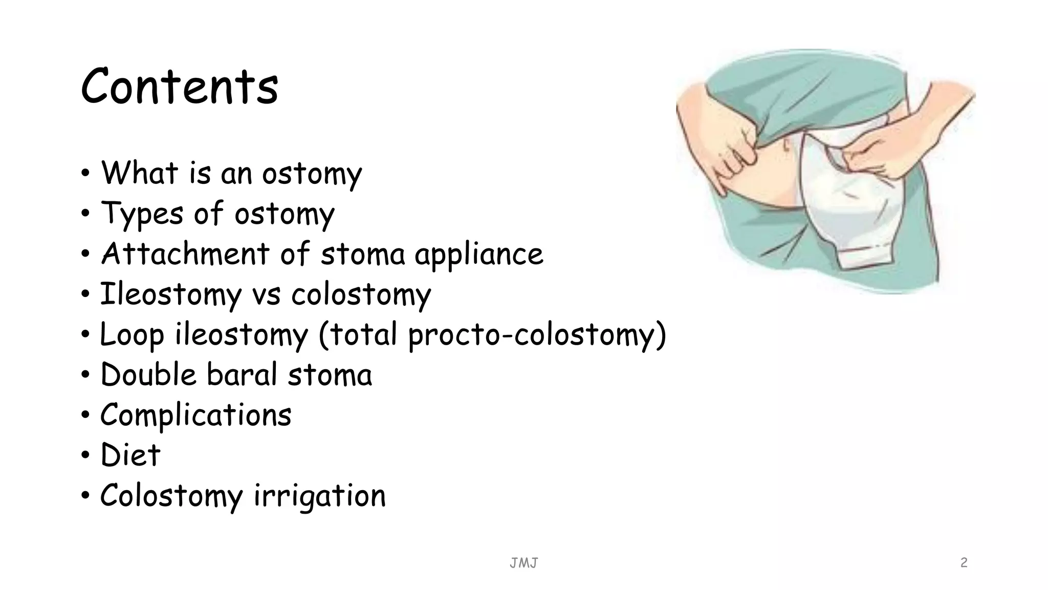 Stoma | PDF