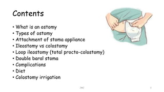 Stoma | PDF