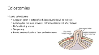 Stoma | PPT