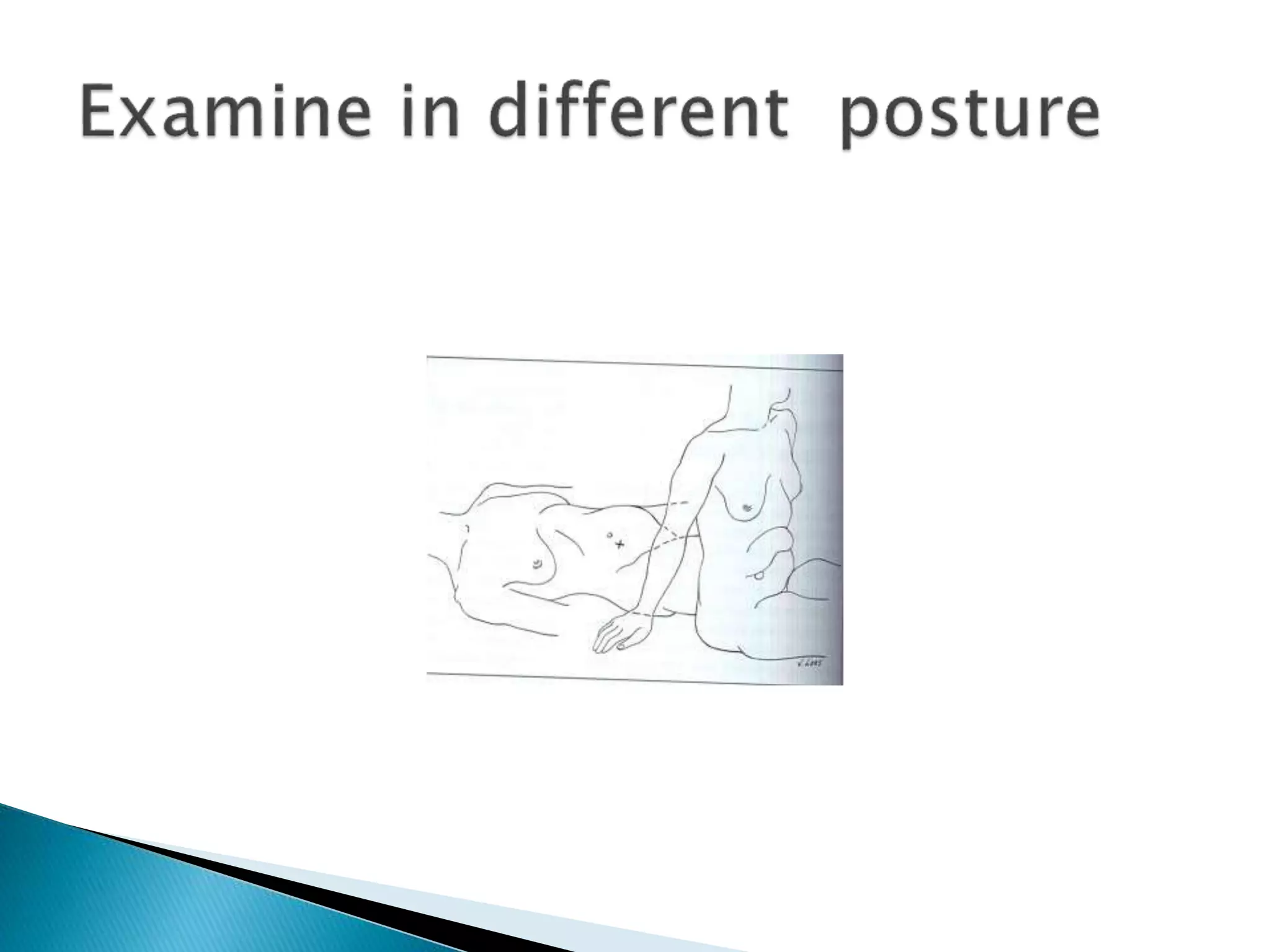 Stoma in surgery | PPT