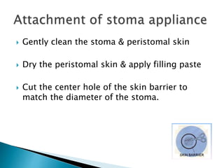 Stoma in surgery | PPT