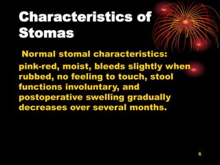 Stoma | PPT