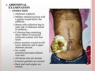 Loop ileostomy | PPTX