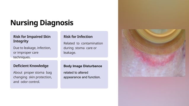 Stoma or (ileostomy and colostomy )and Nursing Care | PPT