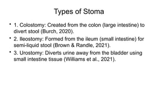 Stoma or (ileostomy and colostomy )and Nursing Care | PPT