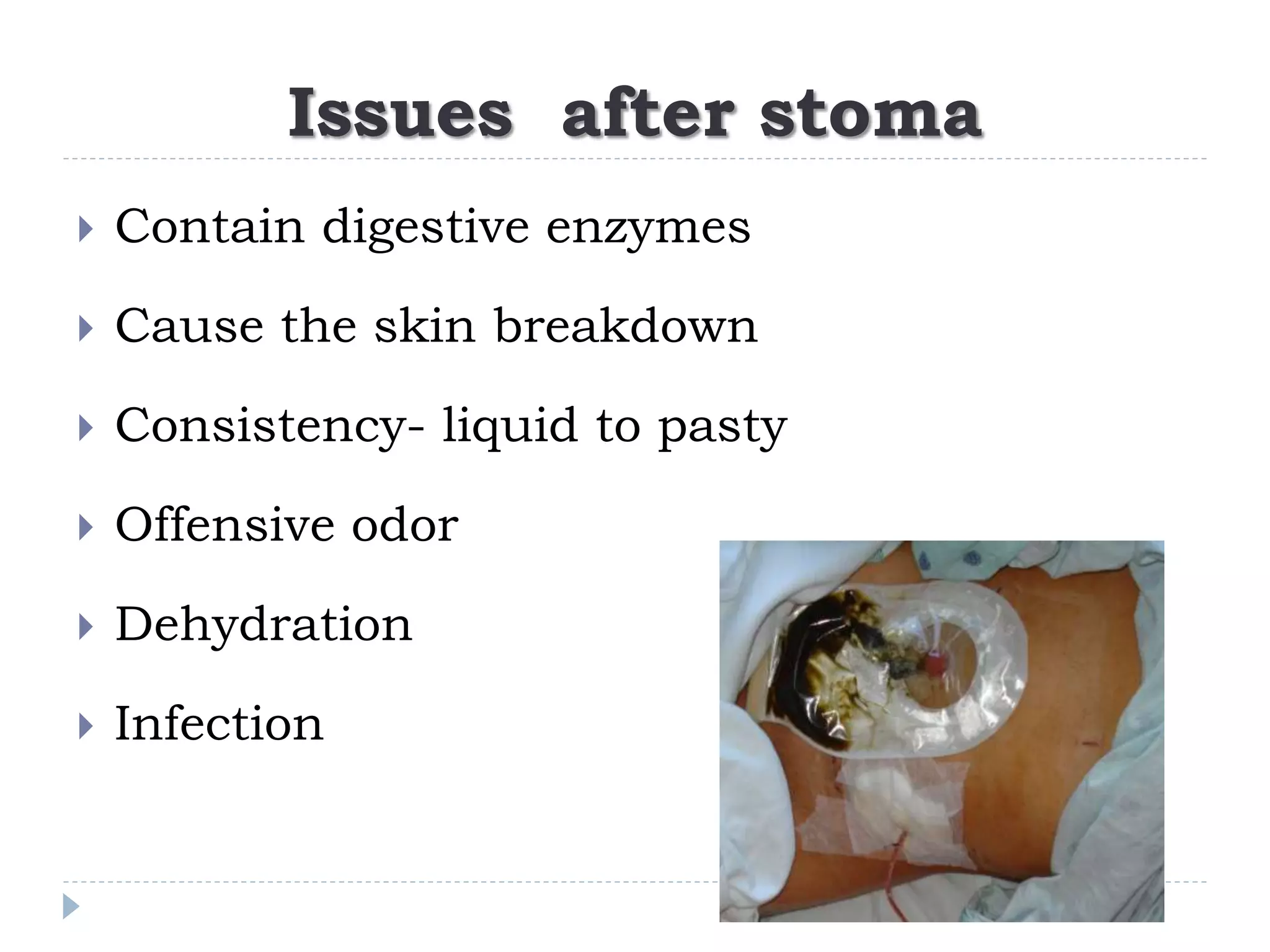 Stoma Care (1).ppt