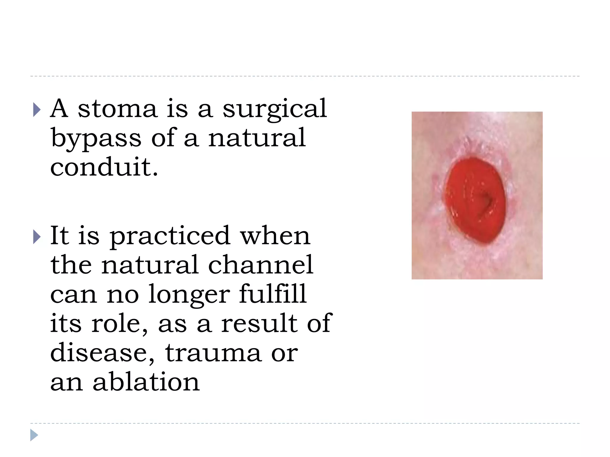 Stoma Care (1).ppt