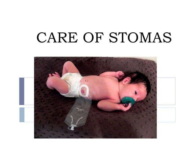 Stoma Care (1).ppt