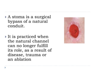Stoma Care (1).ppt