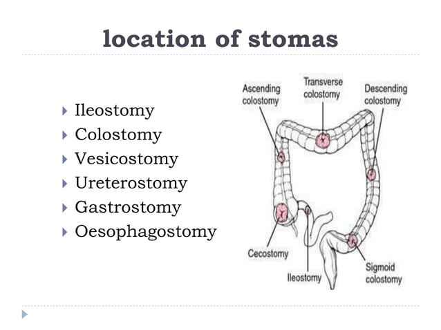 Stoma Care (1).ppt