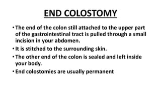 STOMA CARE BY SIS. RAMA.pptx