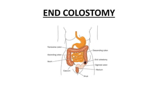 STOMA CARE BY SIS. RAMA.pptx