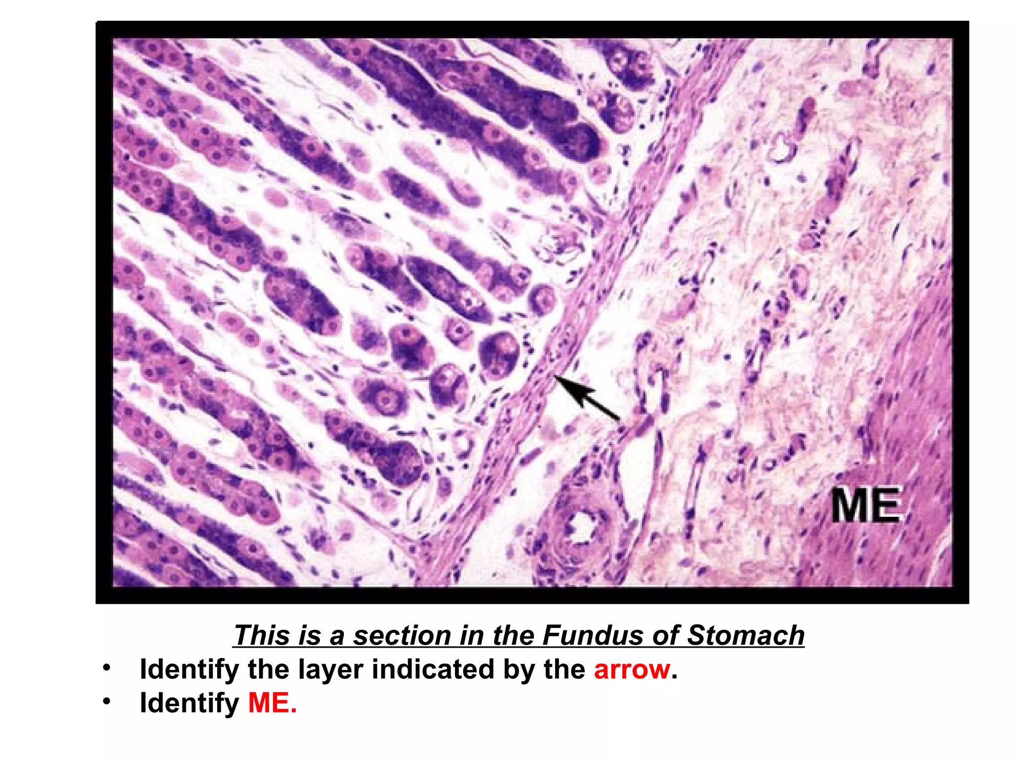Stomach | PPT