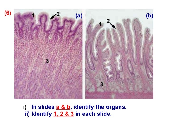 Labeled Stomach Slide