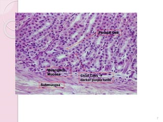Stomach pathology lecture | PPTX