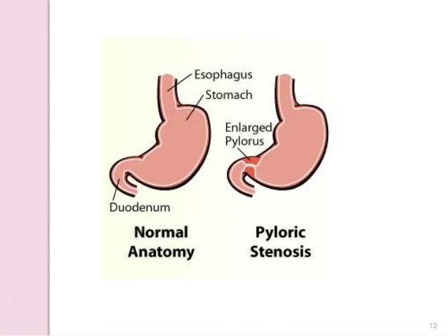 Stomach pathology lecture
