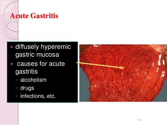 Stomach pathology lecture